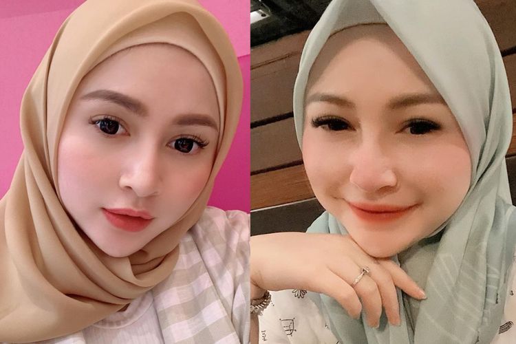 Tubuhnya Kerap Dituduh Hasil Operasi, Begini Kata Selebgram Medan Winny ...