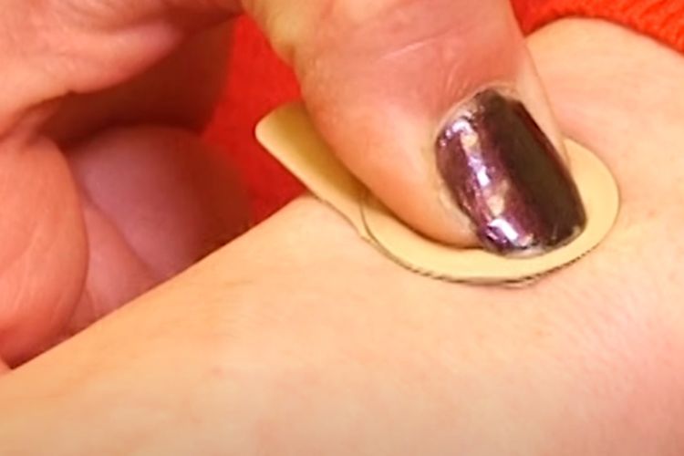 Mengenal Microneedle Patch, Plester Berisi Jarum yang Diisikan Vaksin