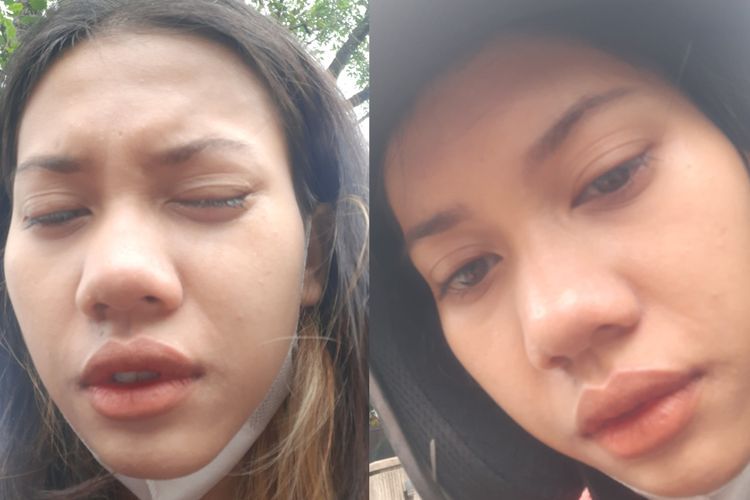 Curhat Wanita Korban Perokok di Jalan, Mata Pedih Terkena Bara Rokok