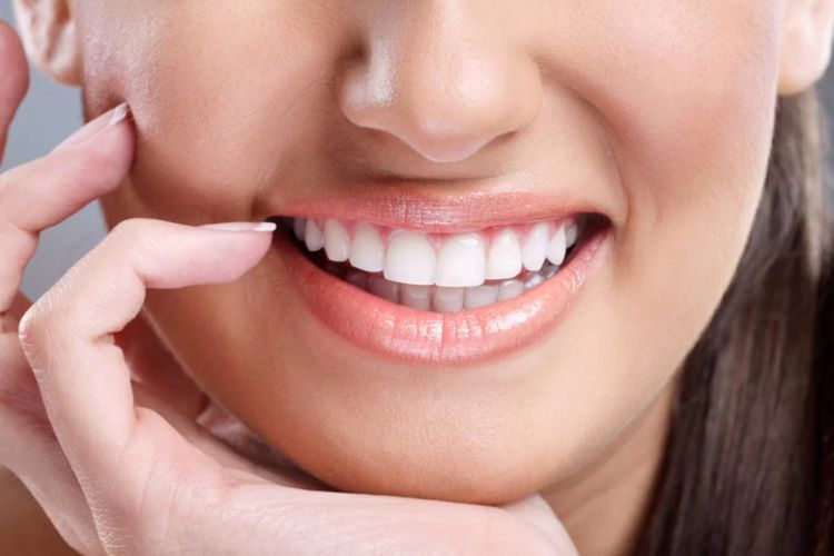 Kenali Bahaya dan Risiko Veneer walau Bikin Gigi Jadi Rapi