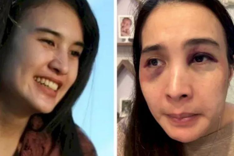 Keuangan Jadi Sumber Masalah Suami Istri di Depok yang Viral Saling KDRT